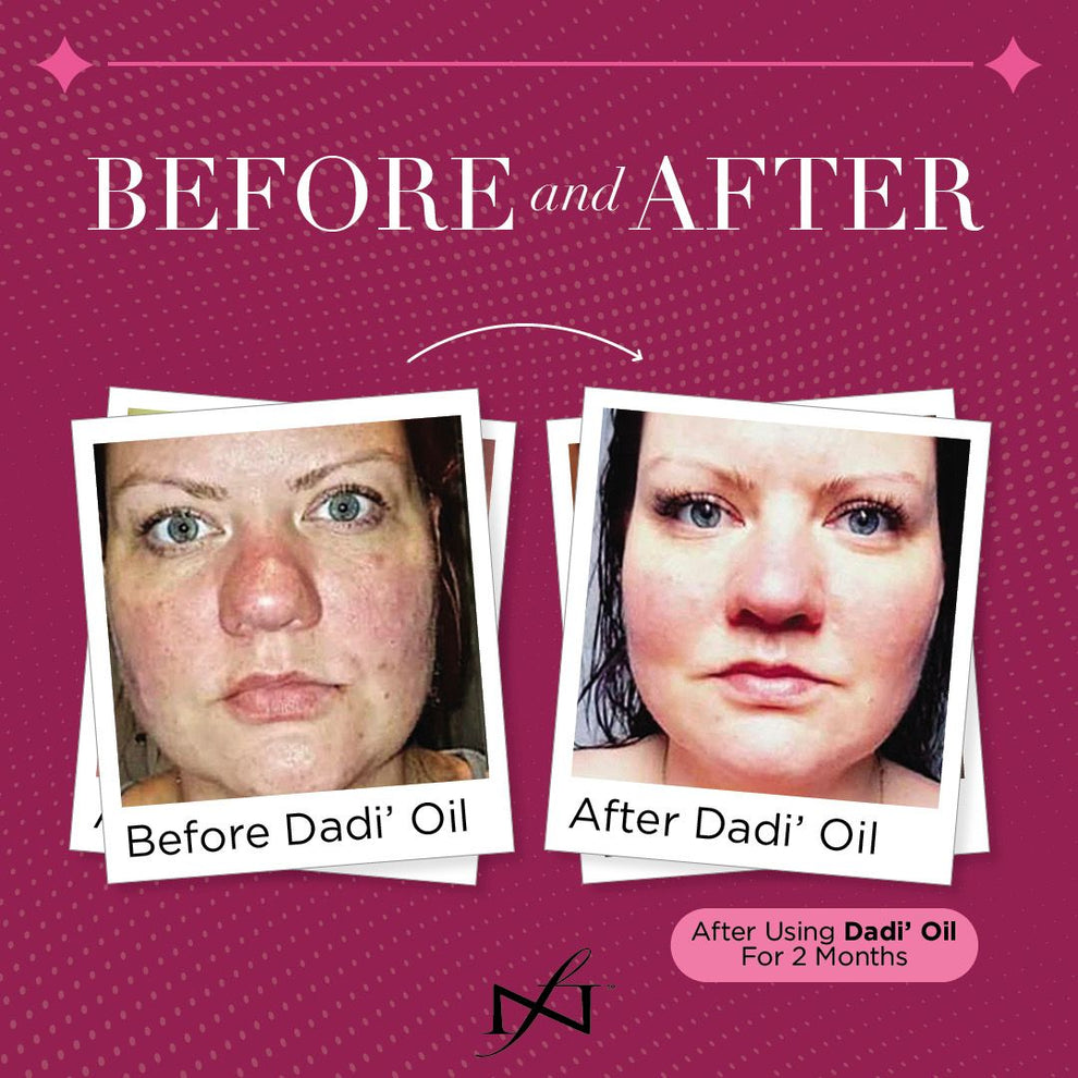 Dadi' Oil – Dadi Oil